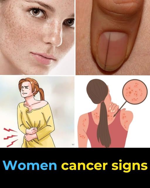 10 Cancer Warning Signs Women Often Overlook - Amazing
